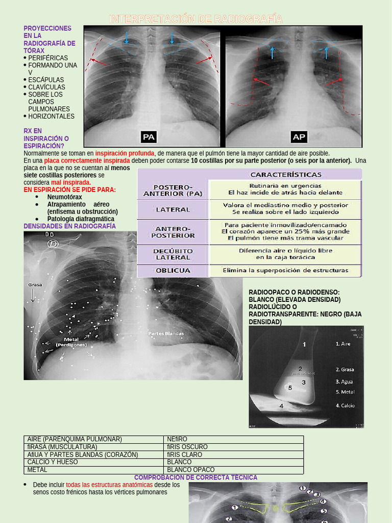 Interpretacion de Radiografia | PDF | Pulmón | Tórax