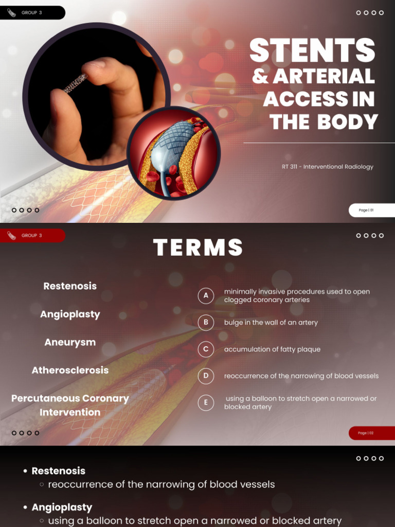 Stents & Arterial Access in The Body | PDF