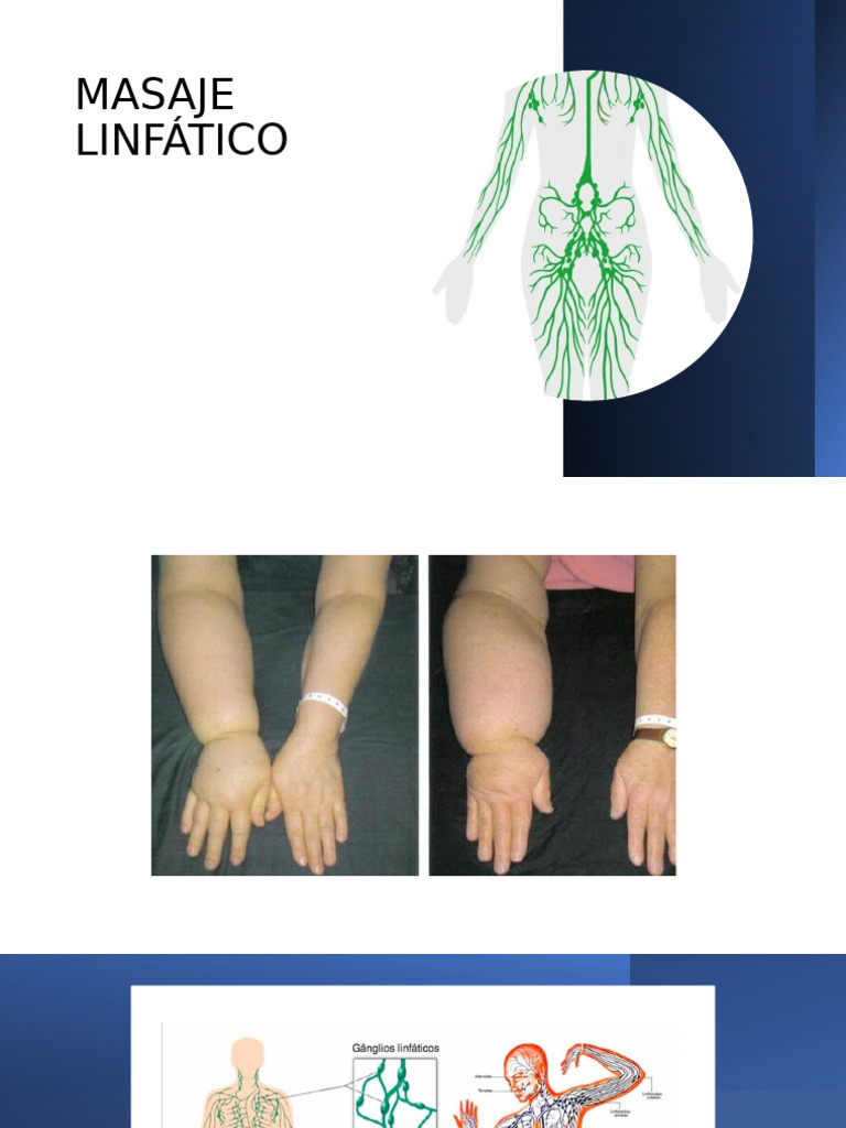 Linfatico Taller | PDF | Masaje | Medicina CLINICA