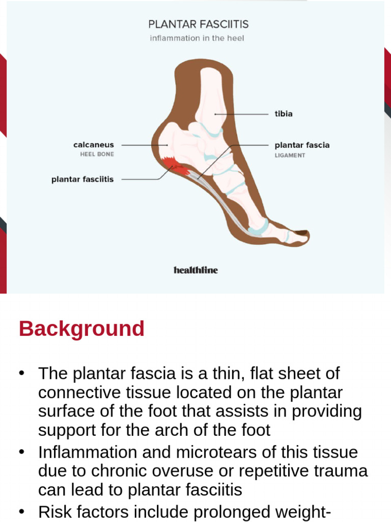 Plantar Fasciitis STUDENT | PDF