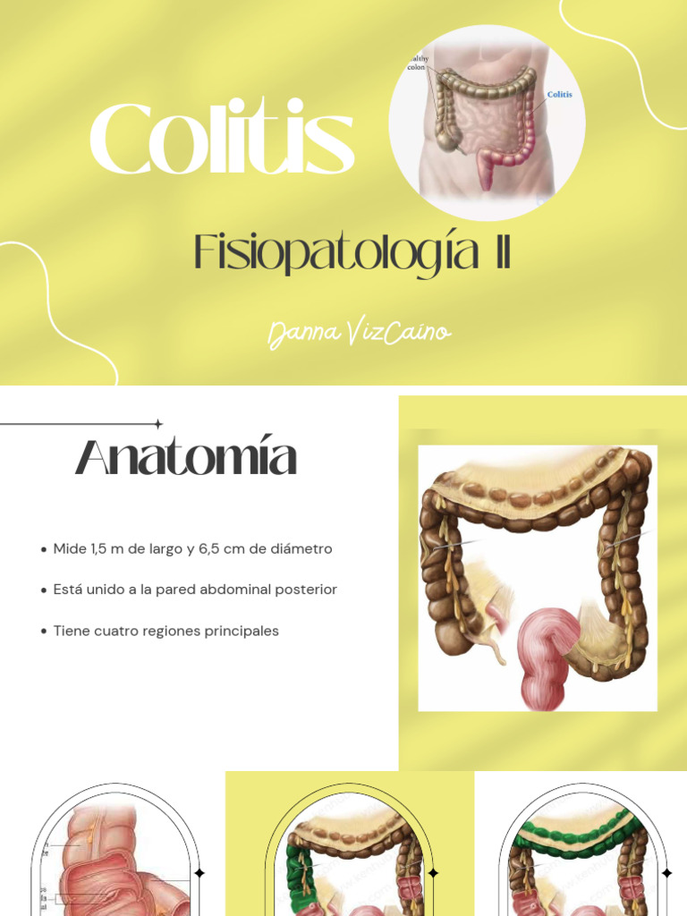 COLITIS - Compressed | PDF | Intestino grueso | Diarrea