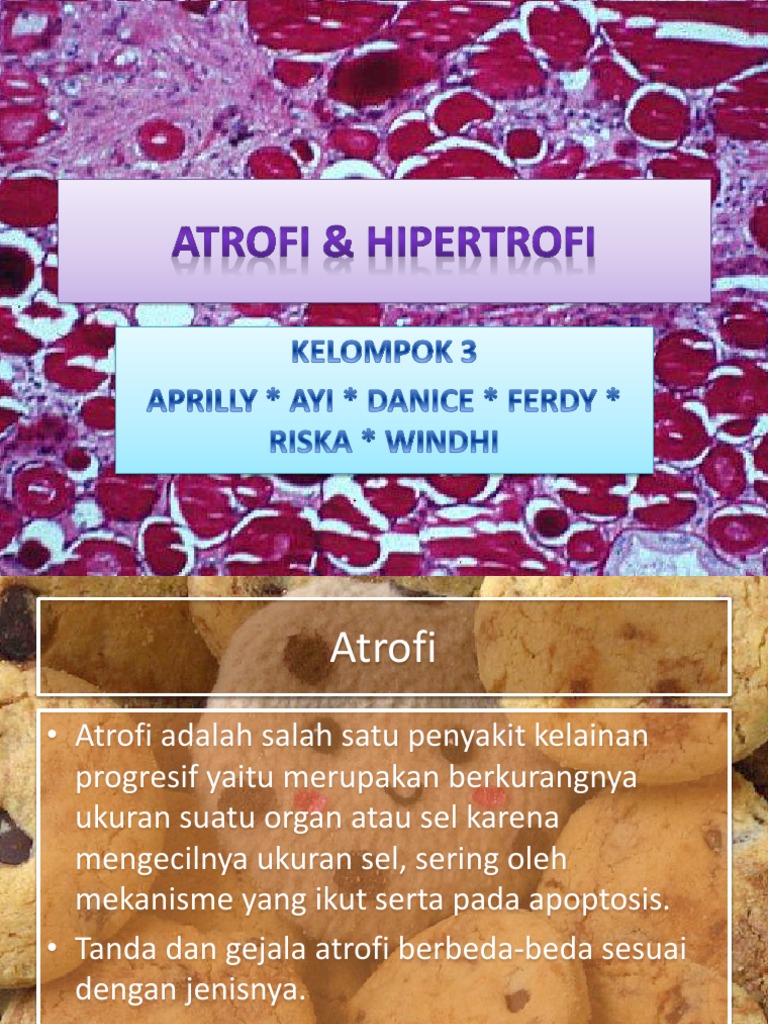 Atrofi & Hipertrofi | PDF | Kesehatan Holistik | Sains & Matematika