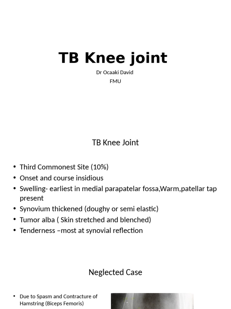 TB Knee | PDF