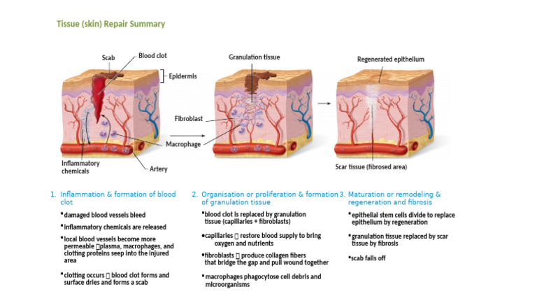 Tissue Repair Summary Figure | PDF