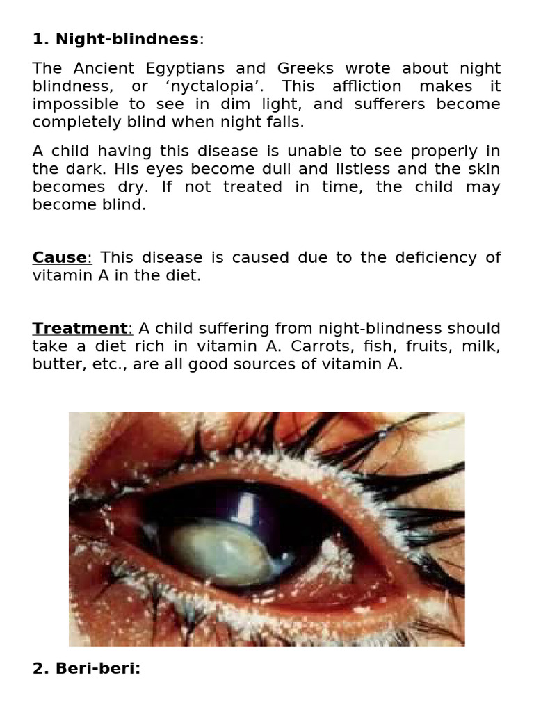 Vitamin A Deficiency and Night Blindness | PDF | Vitamin | Diseases And ...