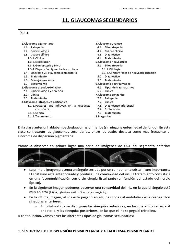 Glaucoma Iii. Glaucomas Secundarios | PDF | Glaucoma | Ojo humano