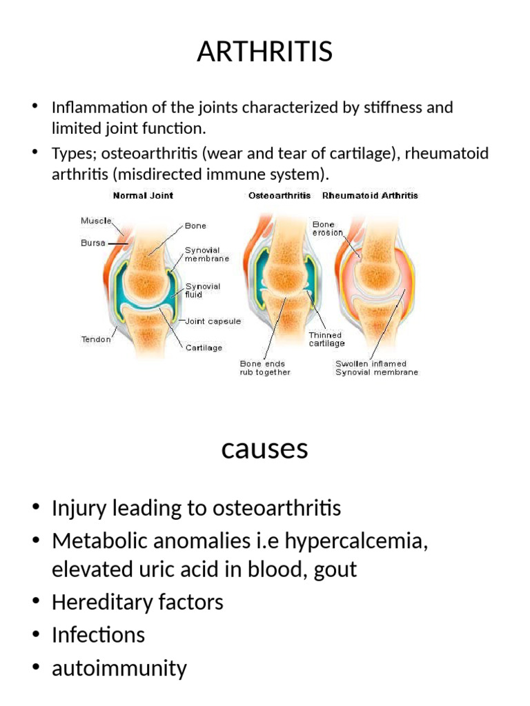 Understanding Arthritis and Related Conditions | PDF | Diabetes | Arthritis