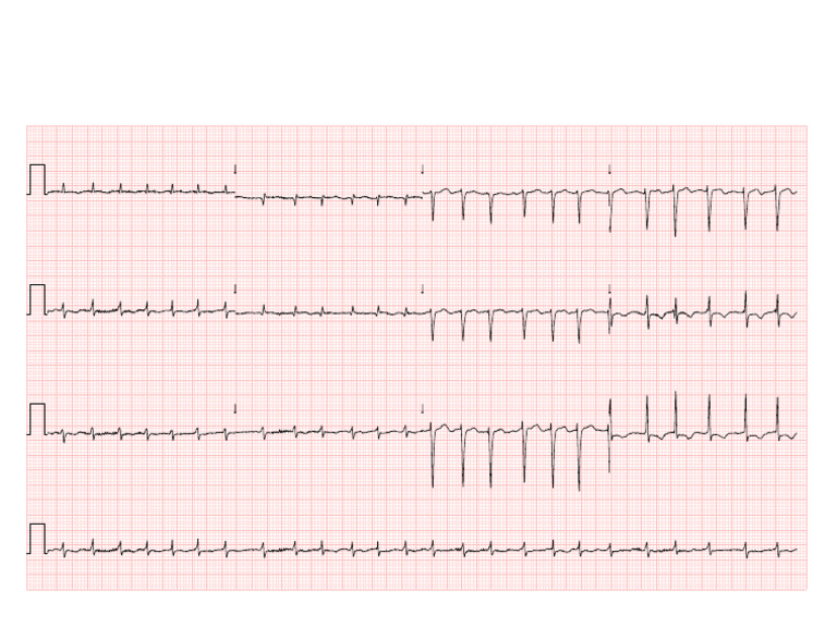R ECG - 0 - 182 Rocha Maria Madalena - 20250314222641 - 20250314214920 ...