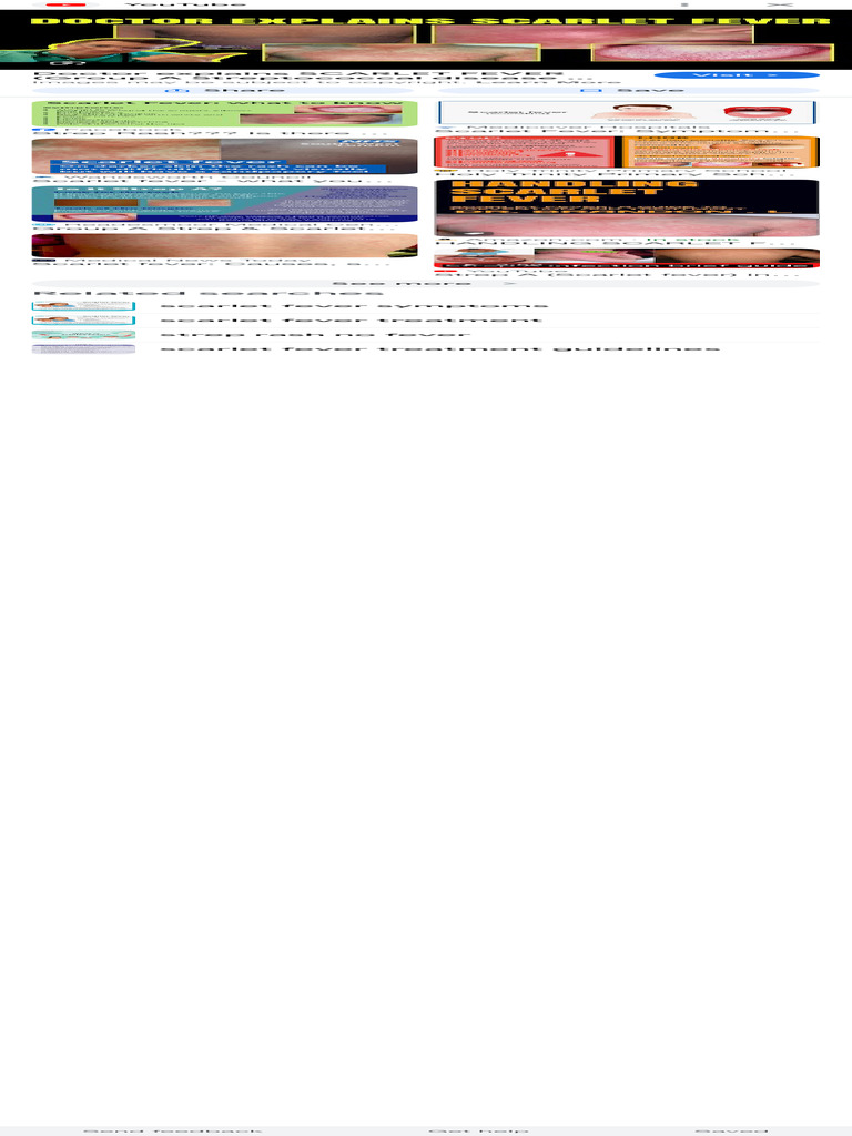 early stage mild scarlet fever rash - Google Search | PDF