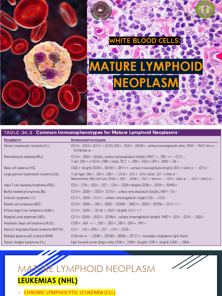 Mature Lymphoid Neoplasm 2.0 | PDF | Lymphoma | Lymphocyte