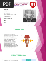 Ejercicios para Rodillas Valgas, Como Enderezar Piernas, Rodilla en X ...