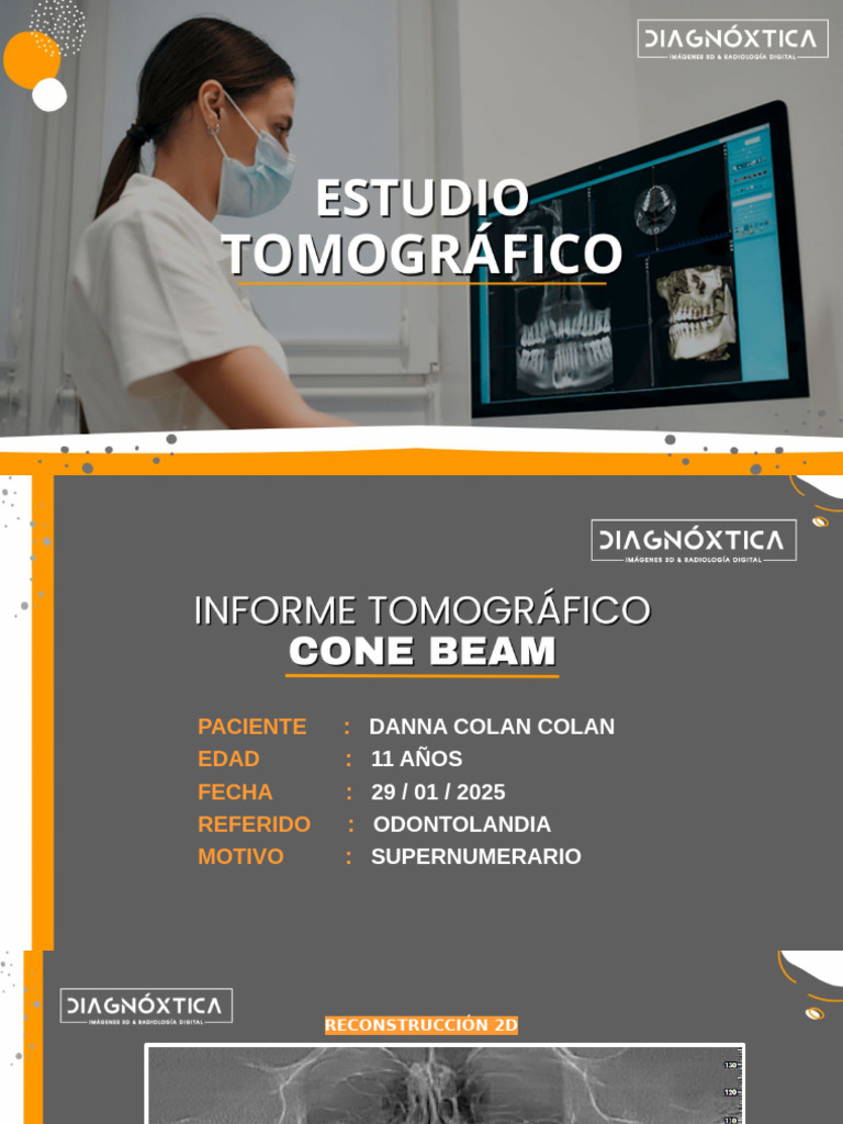 Informe Radiológico: Supernumerario Premolar | PDF