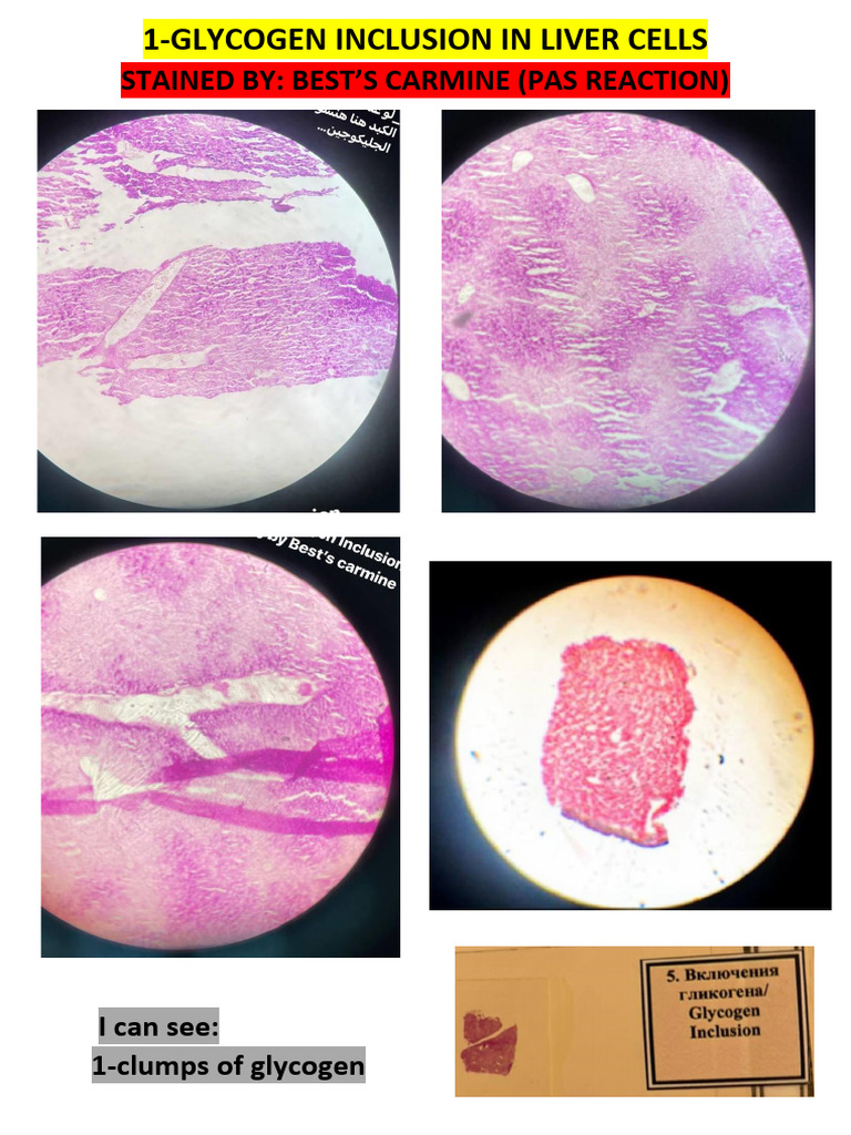 Sinusoidal Capillaries in Glands | PDF | Epithelium | Cardiac Muscle