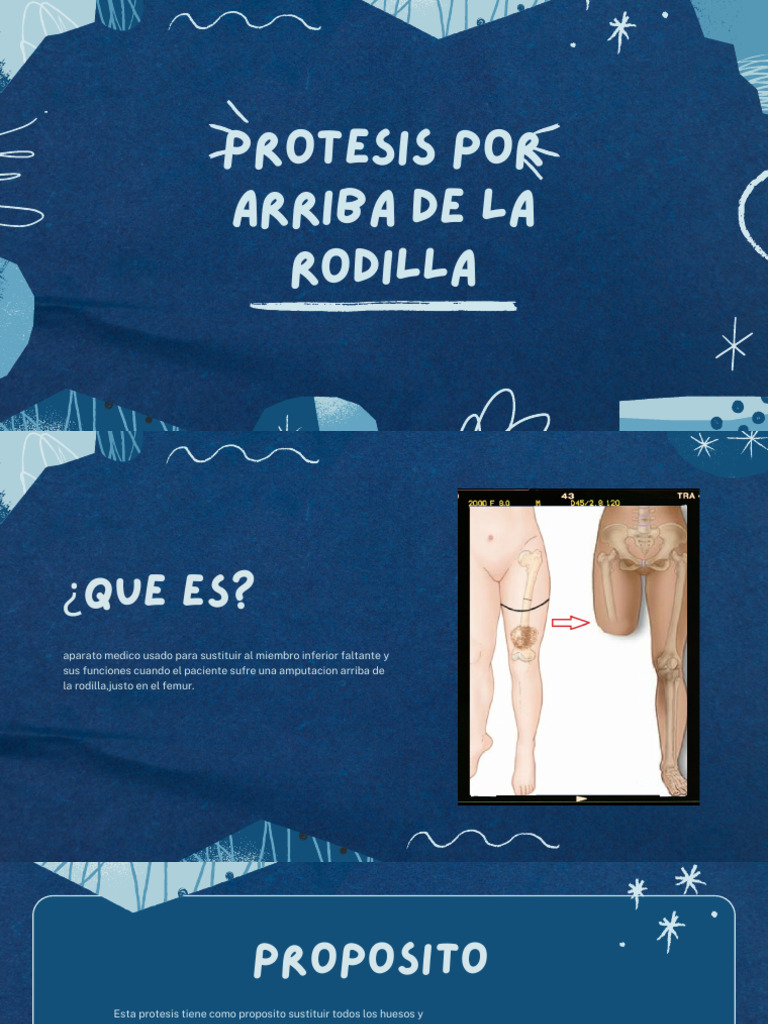 Proyecto 20241105 083221 0000 | PDF