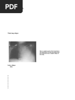 Imaging Techniques for Lung Collapse | PDF | Lung | Medical Specialties