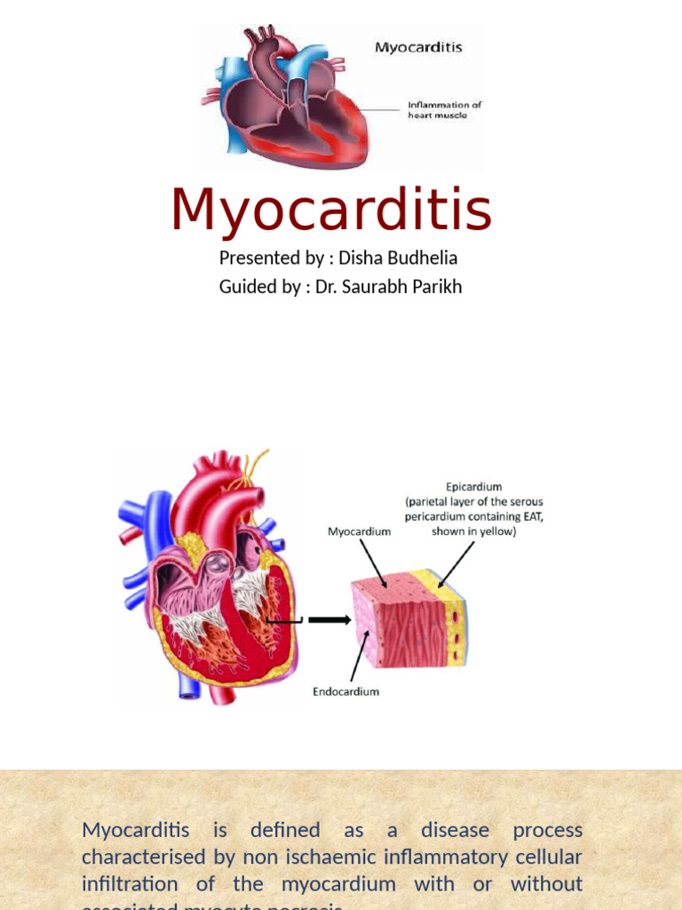 Understanding Myocarditis: Causes & Treatment | PDF | Myocardial ...