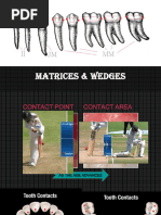 Matrix and Wedge Techniques in Dentistry | PDF | Dentistry Branches