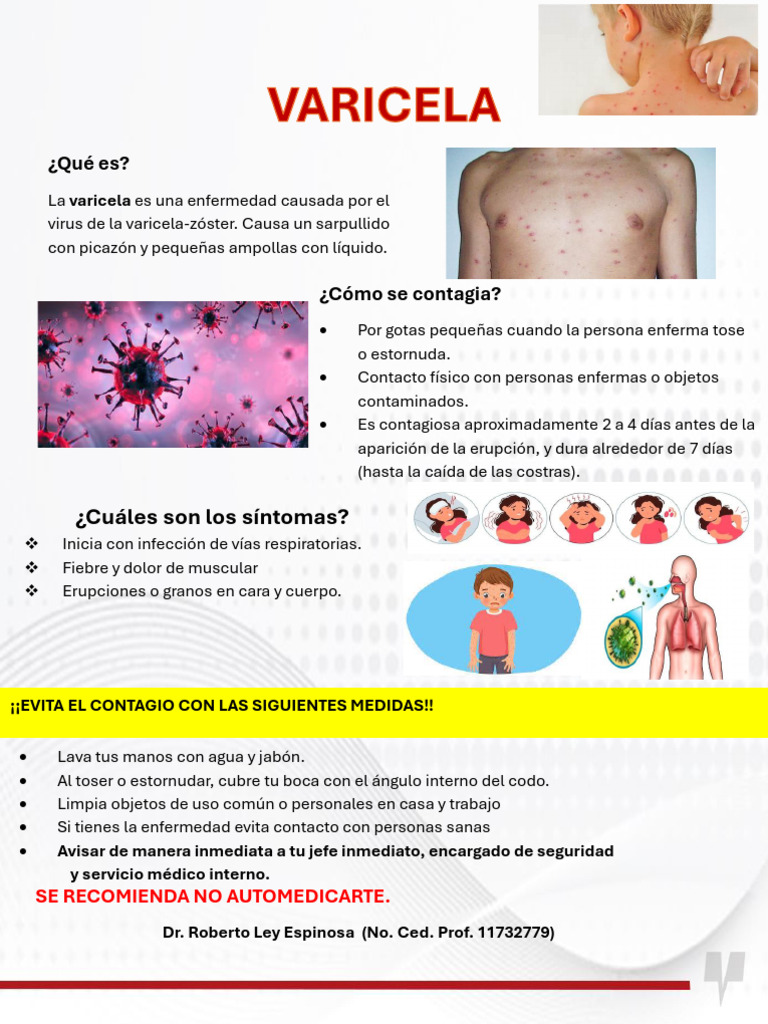 Flyers Varicela | PDF