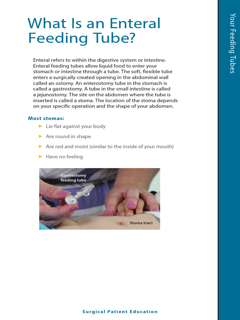 About Your Feeding Tubes | PDF | Medical Procedures | Surgery