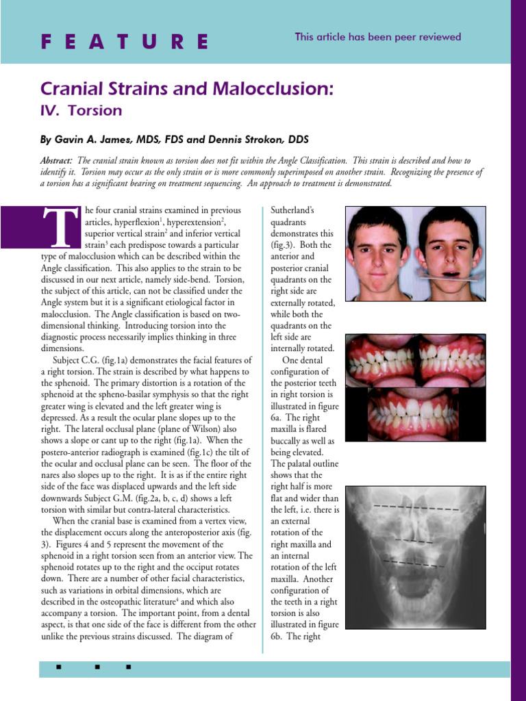 Cranial Strains and Malocclusion IV. Torsion | PDF | Skull | Human Anatomy