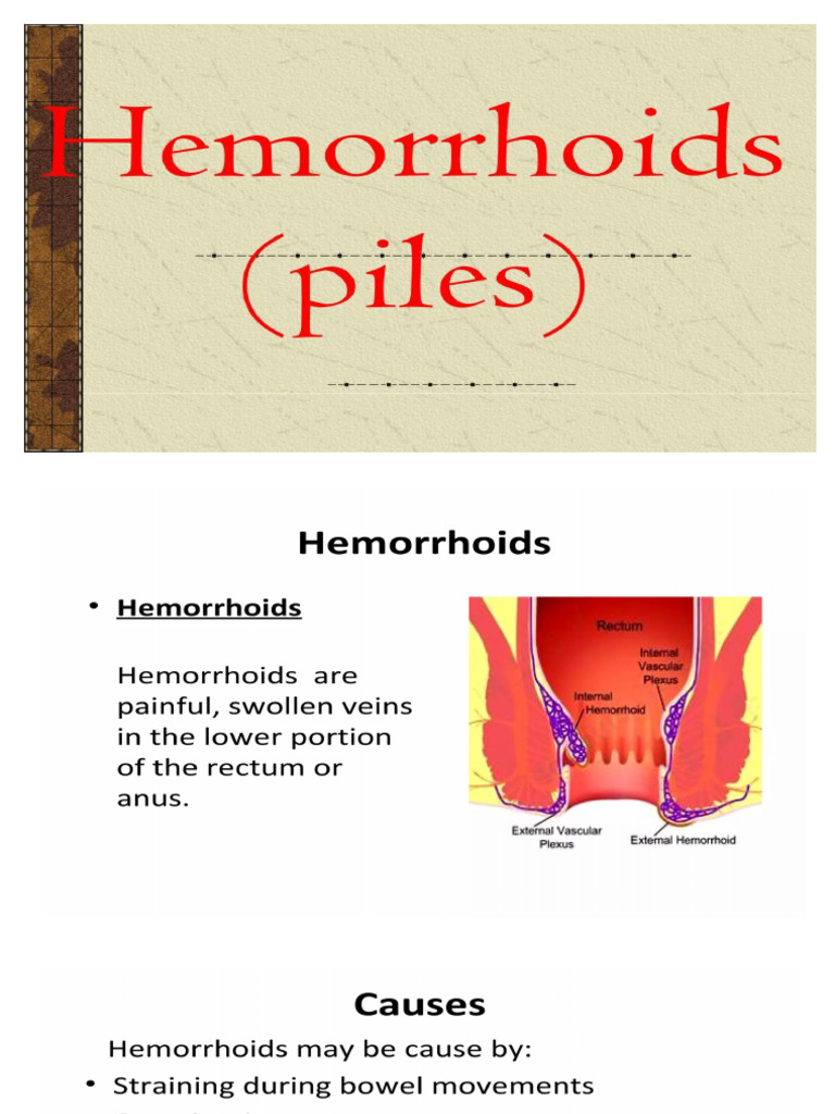 Hemorrhoids | PDF