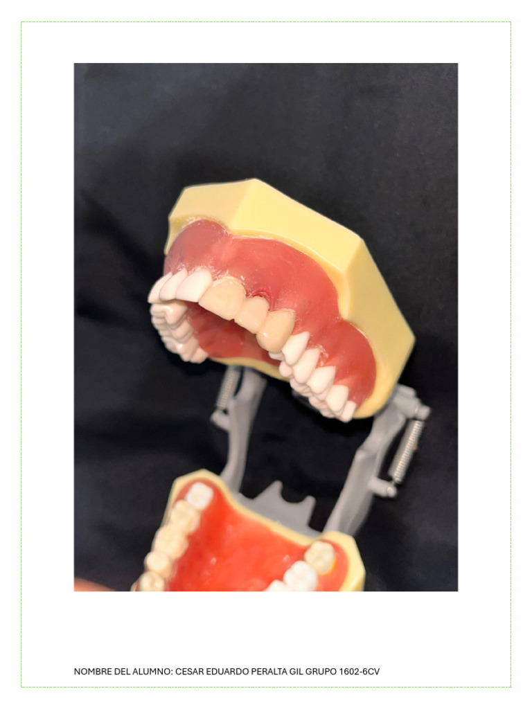 PPF Directa e Indirecta | PDF