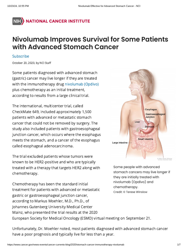 Nivolumab Effective for Advanced Stomach Cancer - NCI | PDF | Cancer | Esophageal Cancer