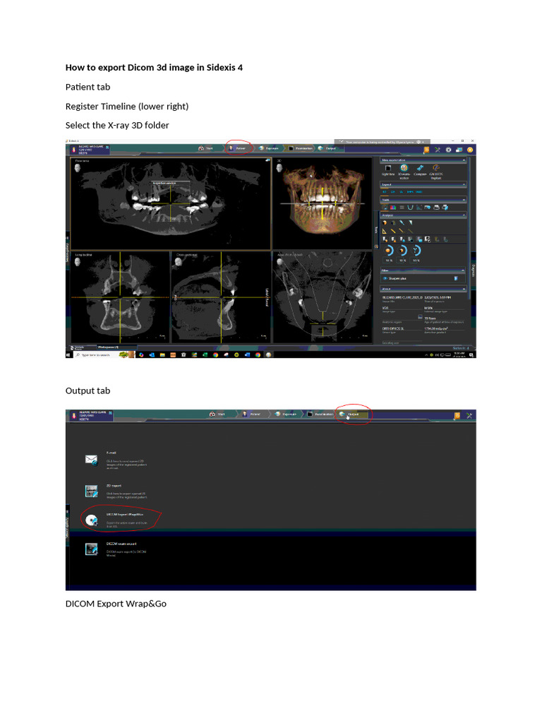 How To Export Dicom 3d Image in Sidexis 4 1 | PDF