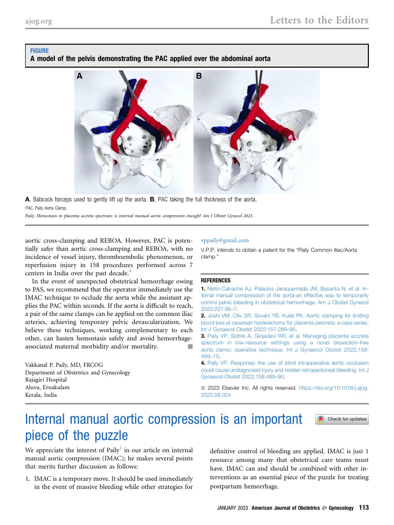 (2023-01) Internal Manual Aorticc Compression Is An Important Piece of ...