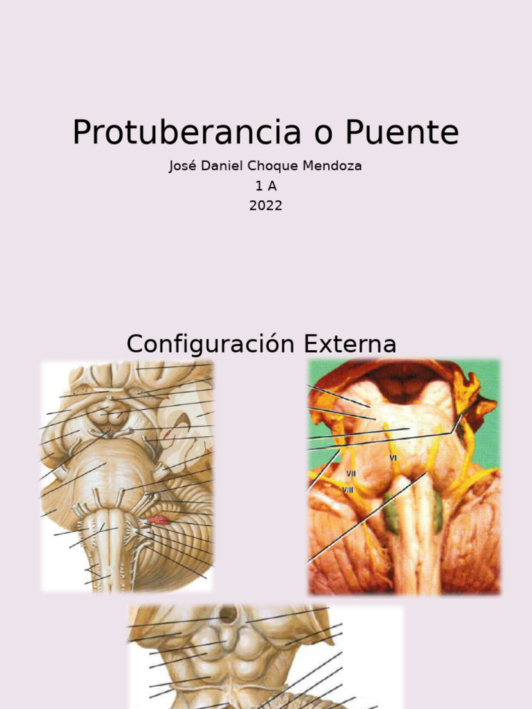 Protuberancia: Síndromes y Tratamientos | PDF