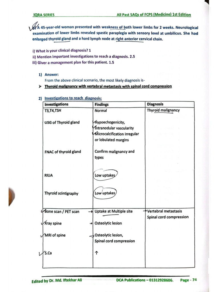 Thyroid Malignancy Pdf