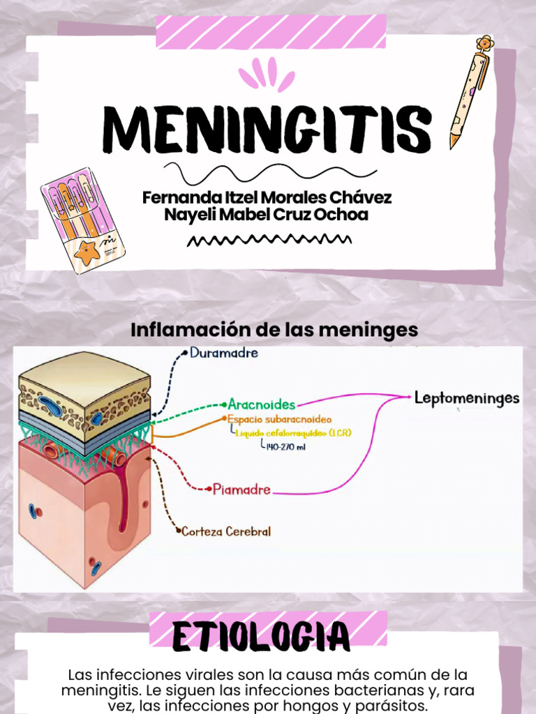 Causas y síntomas de meningitis | PDF | Meningitis | Medicina CLINICA