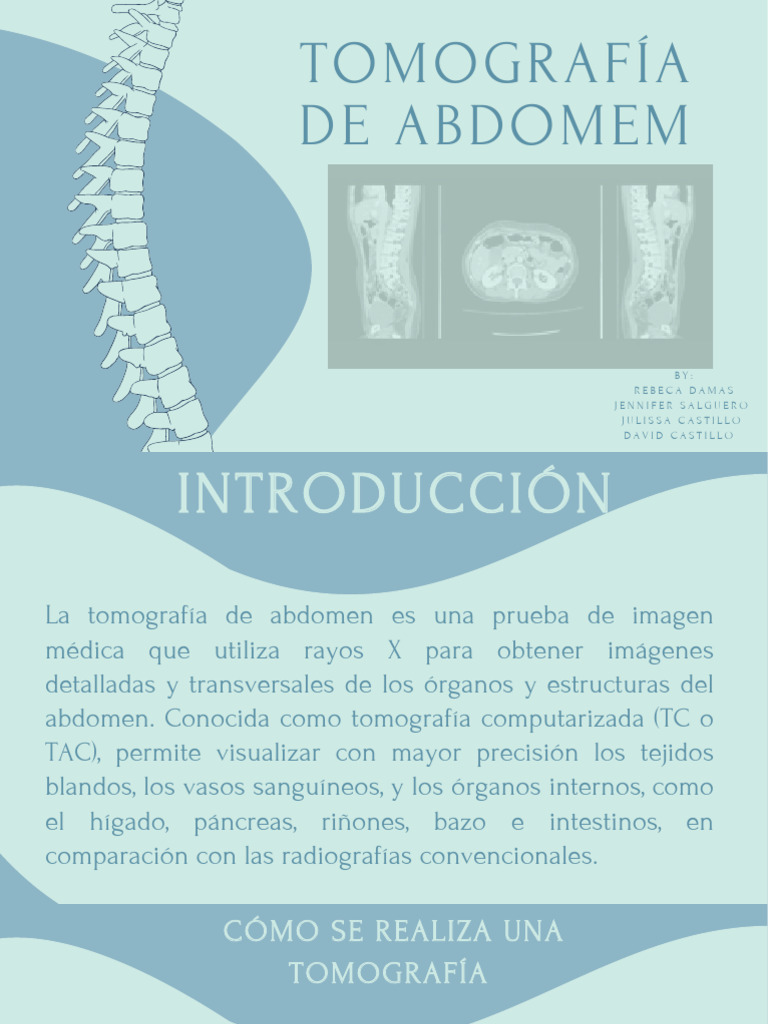 Blue with X-Ray Medical Chiropractic Business Card_20241002_224712_0000 | PDF | Ct Scan | Abdomen