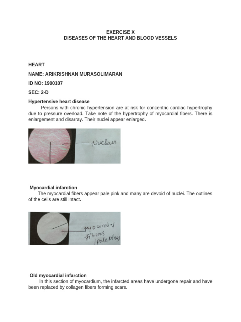 Disease of The Heart and Blood Vessels | PDF | Myocardial Infarction ...