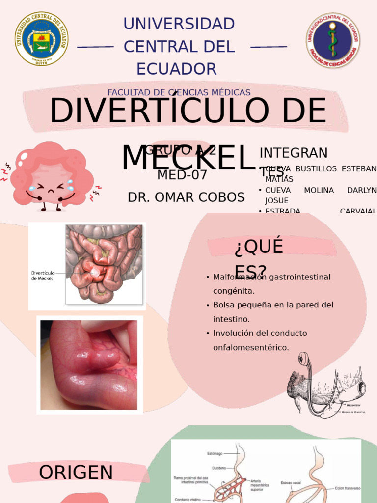 Divertículo de Meckel | PDF | Enfermedades y trastornos | Gastroenterología
