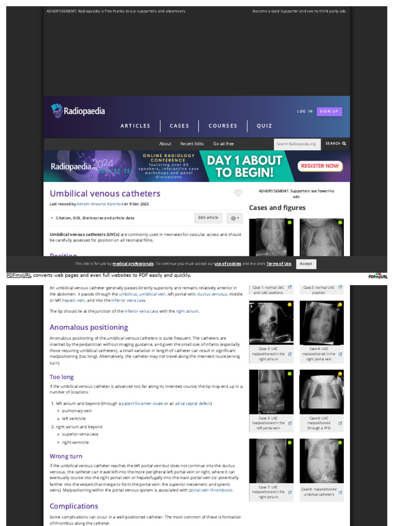 radiopaedia_org_articles_umbilical-venous-catheters | PDF | Vein ...