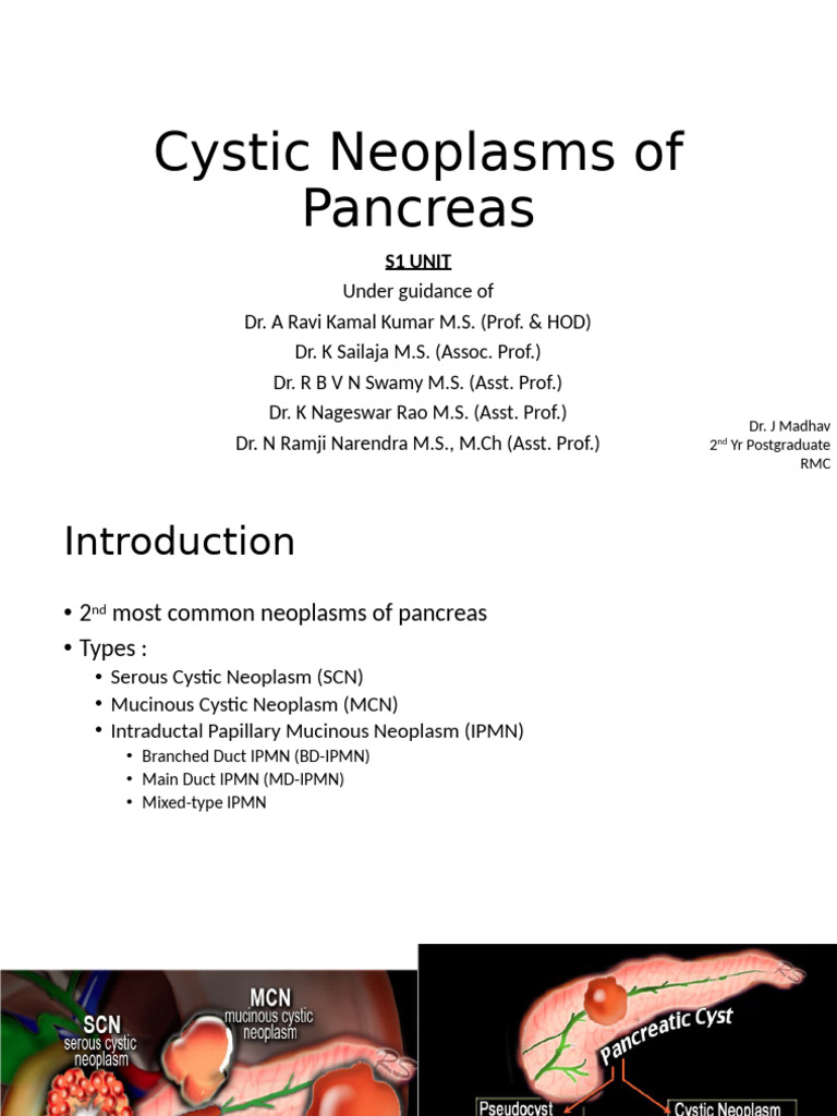 Cystic Neoplasms of Pancreas | PDF | Neoplasms | Medical Specialties