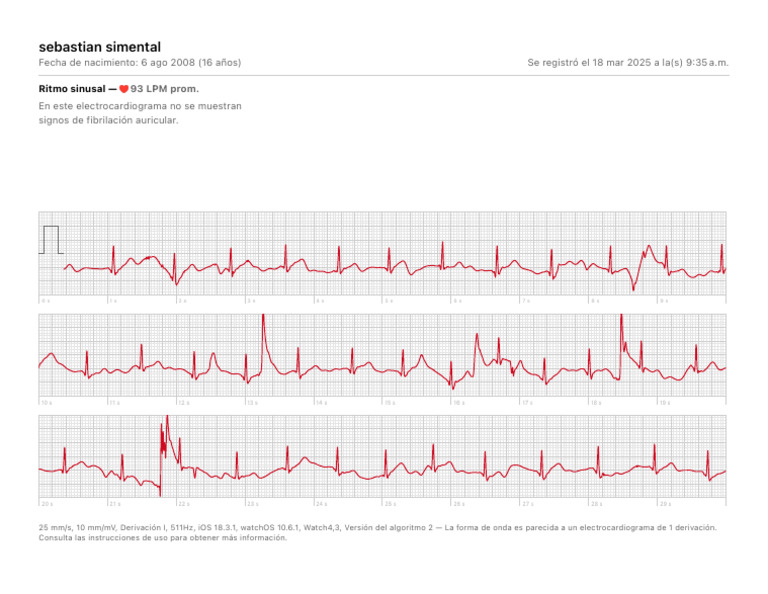 Salud - Sebastian Simental - ECG Del 2025-03-18 A Las 09.35 | PDF