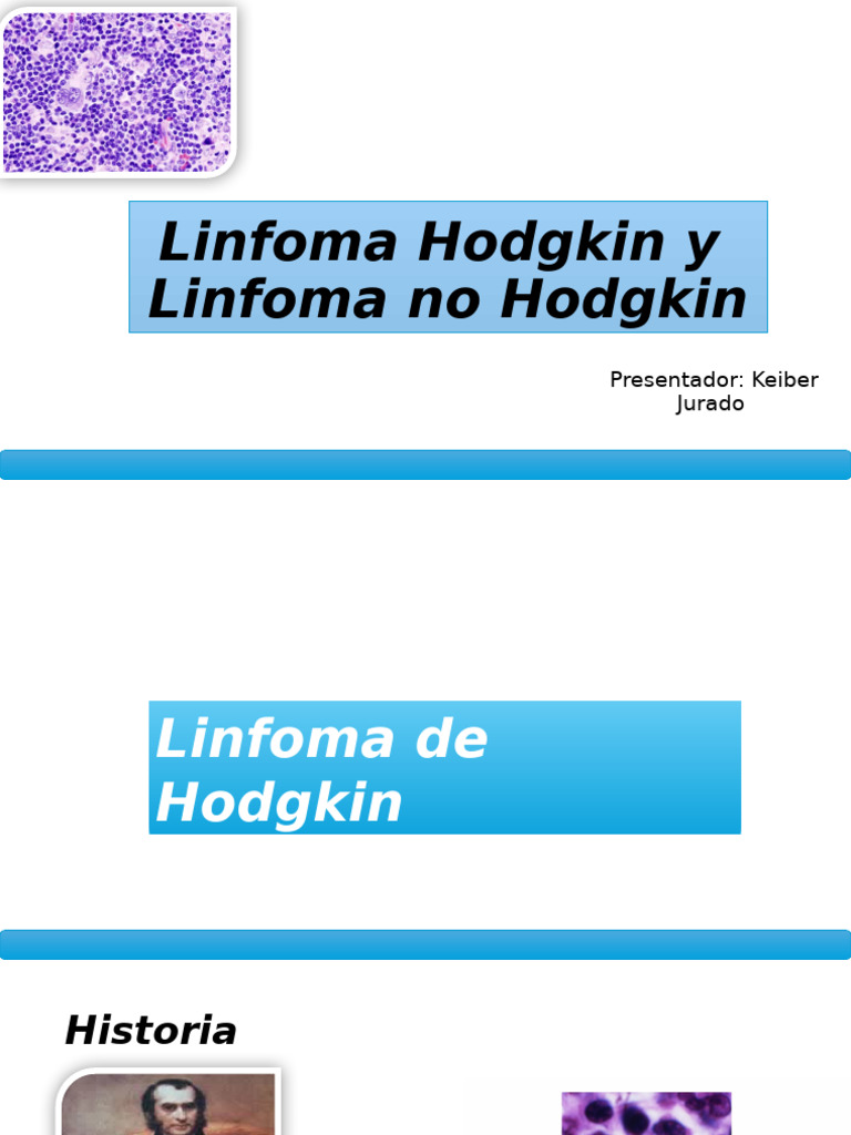 HODGKIN | PDF | Linfoma | Linfocitos
