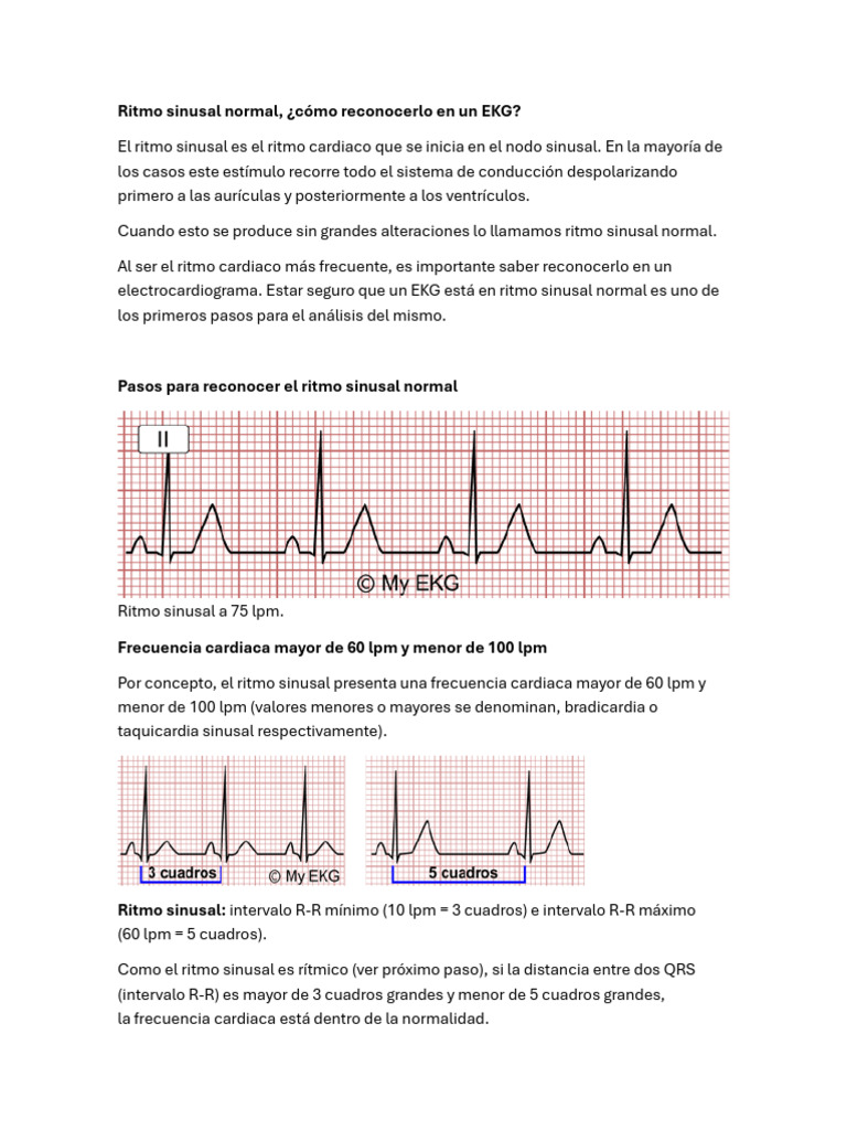 16 - Ritmo Sinusal Normal | PDF | Cardiología | Corazón