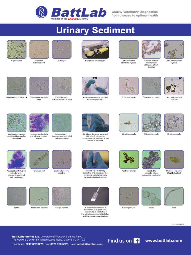 Urine Sediments | PDF