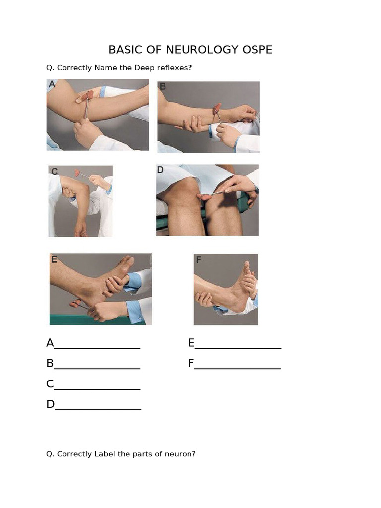 Neurology OSPE | PDF