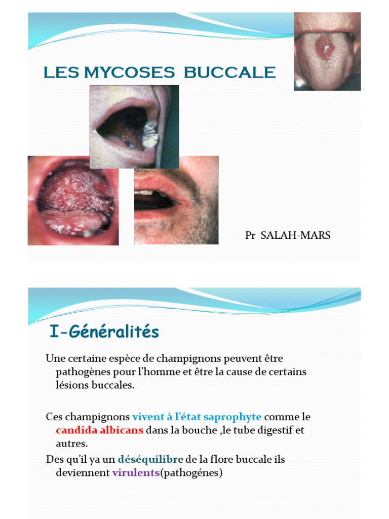 Candidoses buccales : types et traitements | PDF | Candidose | Candida