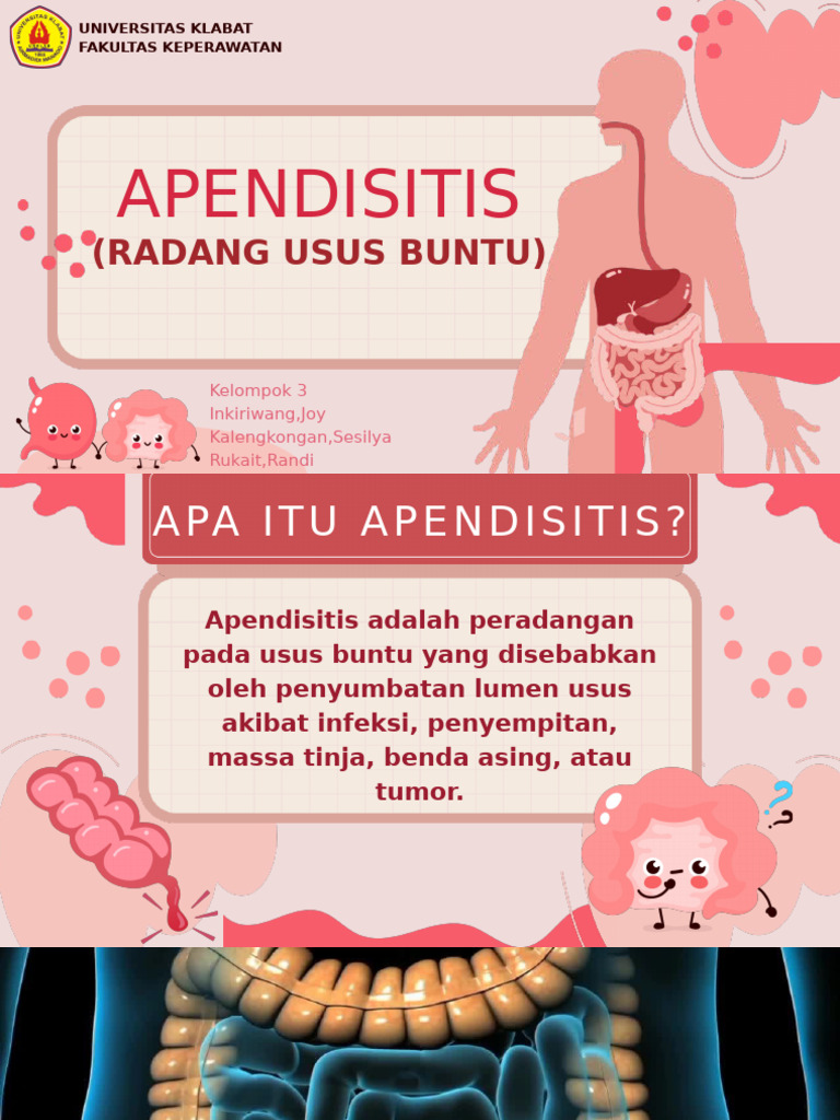 APPENDICITIS | PDF