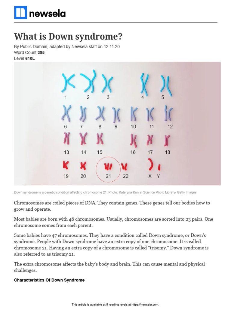 Lib What Is Down Syndrome 2001016402 Article - Only | PDF | Down Syndrome | Chromosome