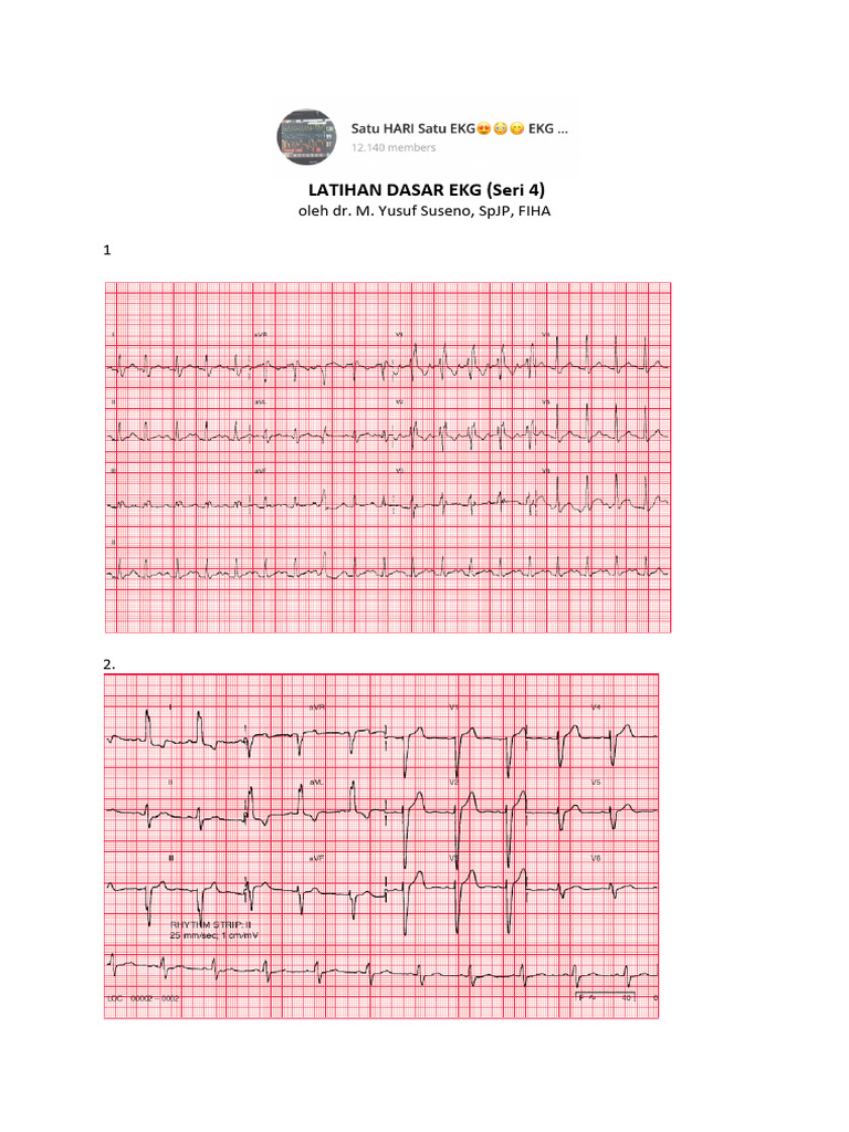 Latihan Dasar Membaca Ekg Seri 4 | PDF