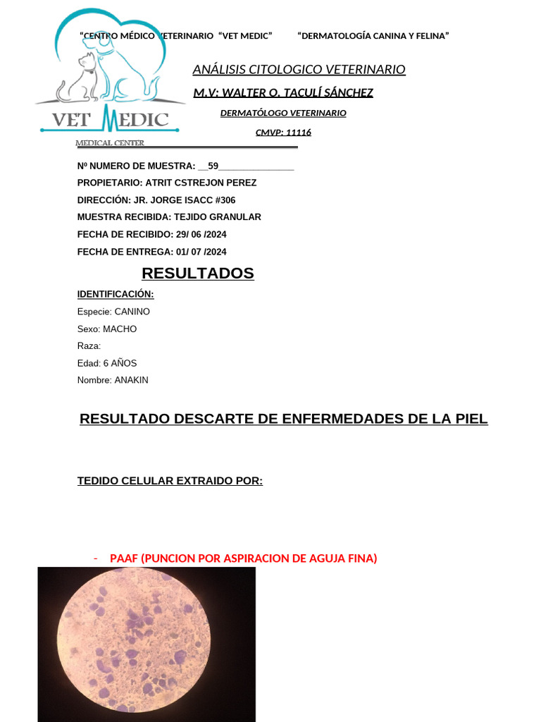 Análisis de Anisocariosis y Anisocitosis | PDF
