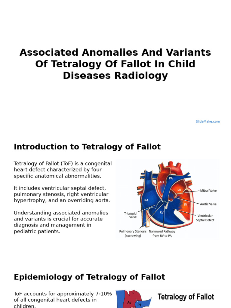 Associated Anomalies and Variants of Tetralogy of Fallot in Child Diseases Radiology | PDF ...