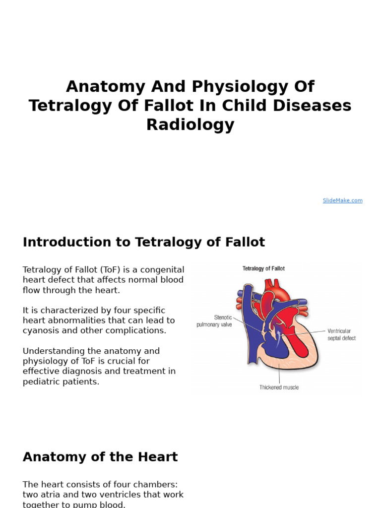 Anatomy And Physiology Of Tetralogy Of Fallot In Child Diseases Radiology | PDF | Congenital ...