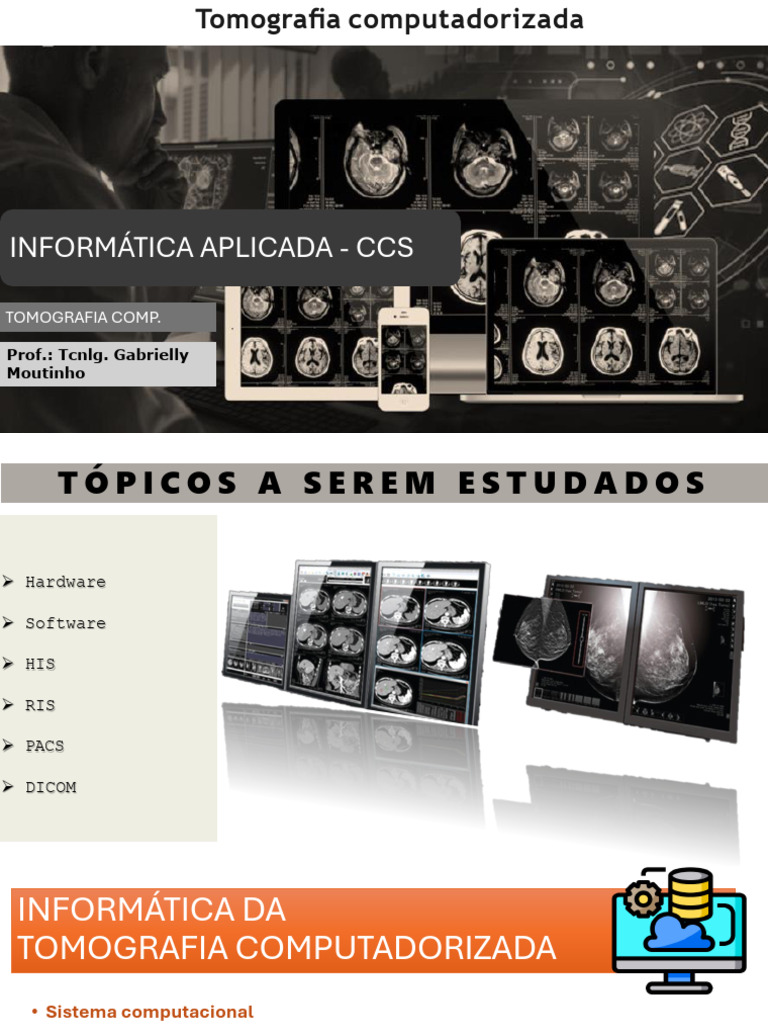 INFORMATICA APLICADA - Tomog Comput - CCS | PDF | Hardware de computador | Tomografia ...